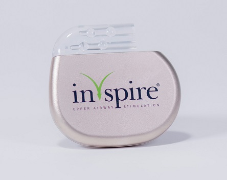 Getting Inspire Therapy for Sleep Apnea Covered - AAPC Knowledge Center