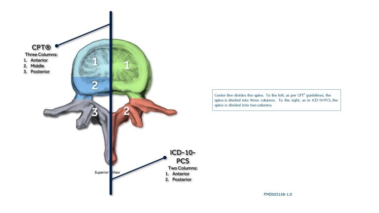 Bone Up on Lumbar Spinal Fusion - AAPC Knowledge Center