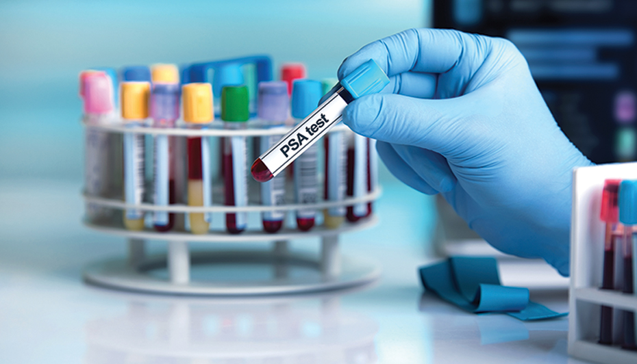 3 Tips For Proper PSA Test Coding AAPC Knowledge Center