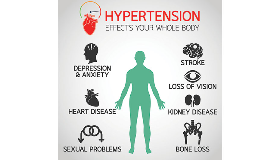 Elevate Your Knowledge Of Hypertension Coding AAPC Knowledge Center