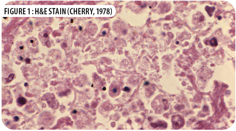 Identify How to Get Paid for Special Stains - AAPC Knowledge Center