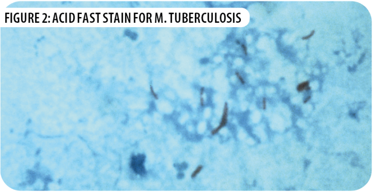 Identify How to Get Paid for Special Stains - AAPC Knowledge Center