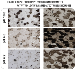 Identify How to Get Paid for Special Stains - AAPC Knowledge Center
