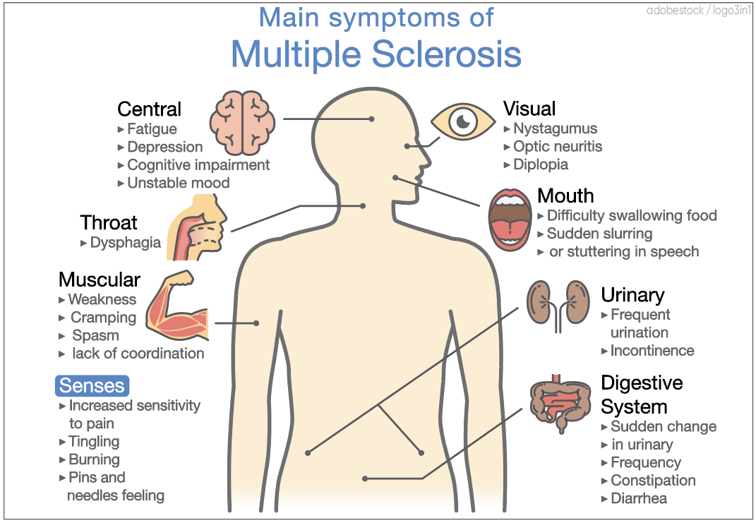 Coming to Terms With MS - AAPC Knowledge Center