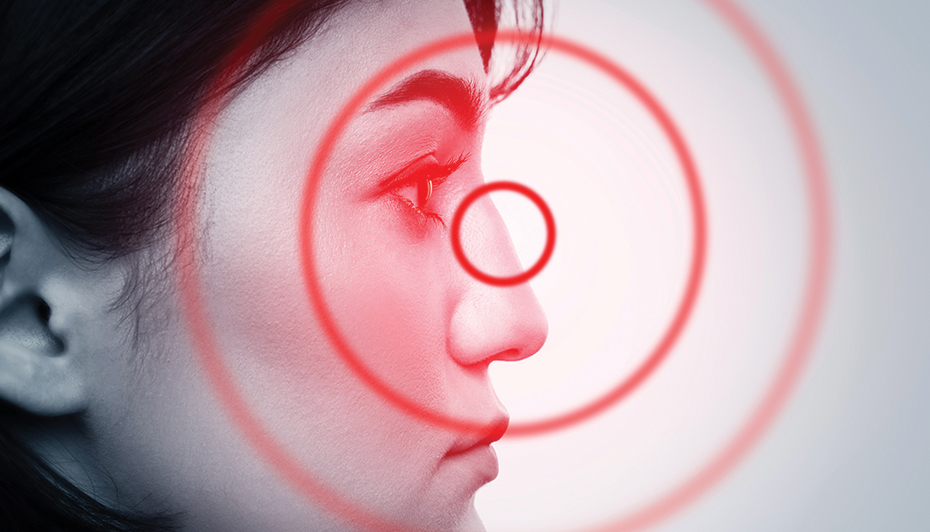 Coding Posterior Nasal Nerve Ablation - AAPC Knowledge Center