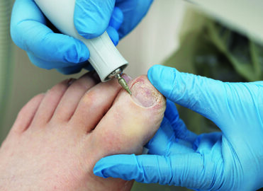Does Medicare Cover Routine Foot Care? - AAPC Knowledge Center