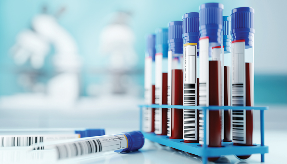 Minimal Residual Disease (MRD) Testing - AAPC Knowledge Center