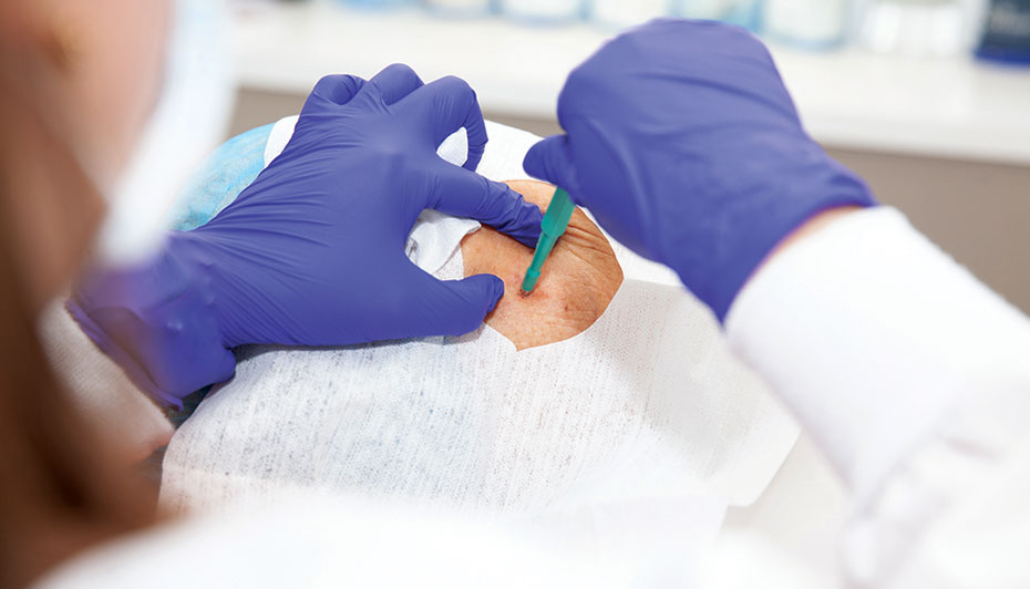 Minor Skin Procedures in the Office - AAPC Knowledge Center