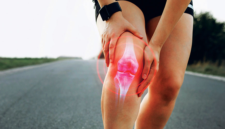 Partial vs. Total Knee Arthroplasty - AAPC Knowledge Center