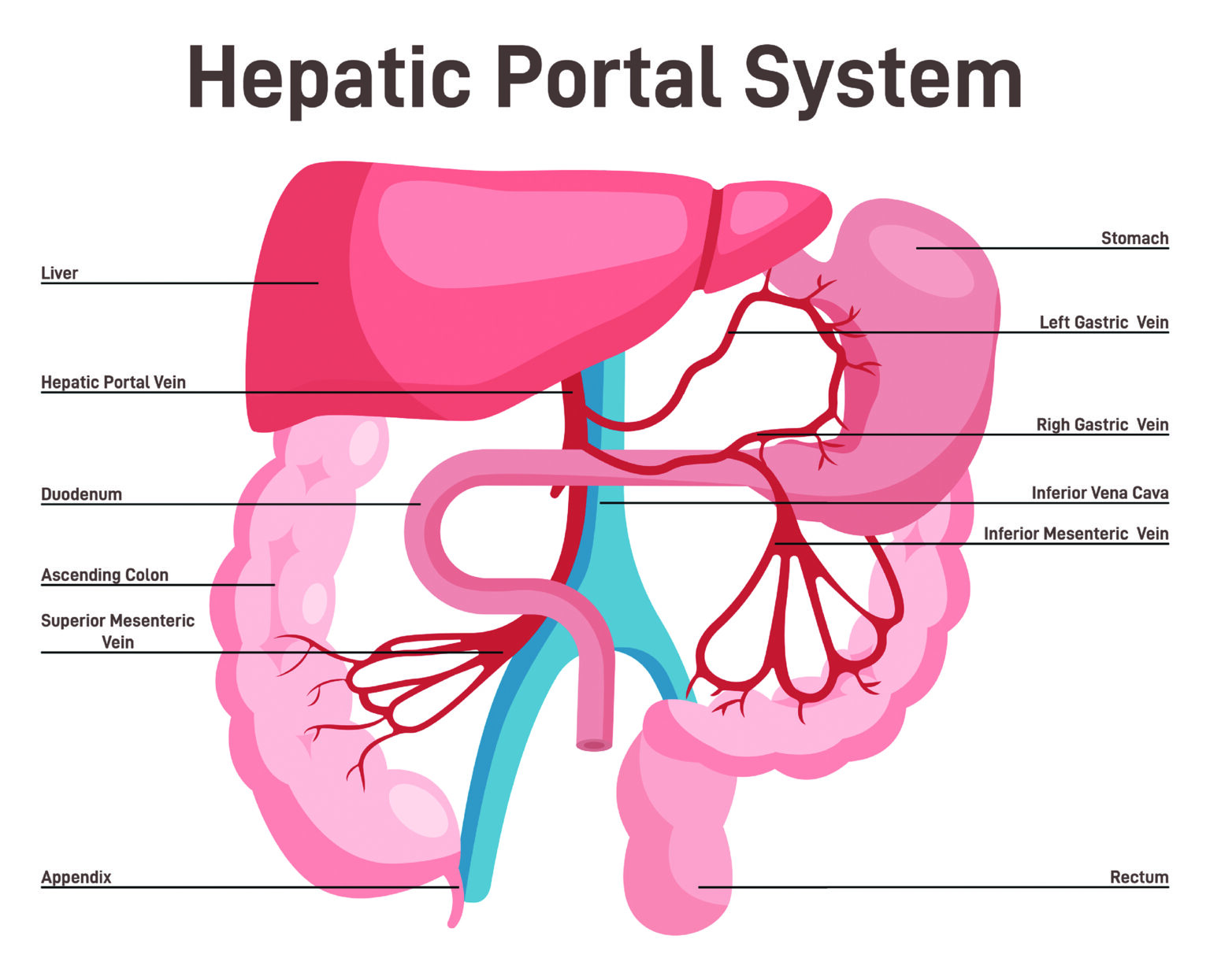 Coding Simulation Angiogram for Tumor Radioembolization - AAPC ...